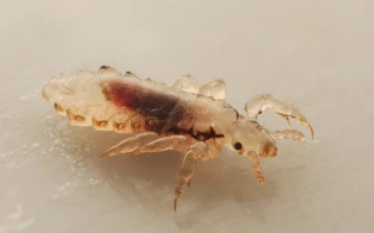 A quoi ressemble une lente - traitements anti-poux